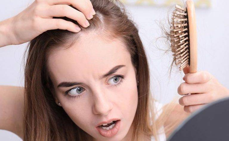 Alopecia Androgenetica Femminile: tipologie, cause, effetti e rimedi Alopecia Androgenetica Femminile: tipologie, cause, effetti e rimedi